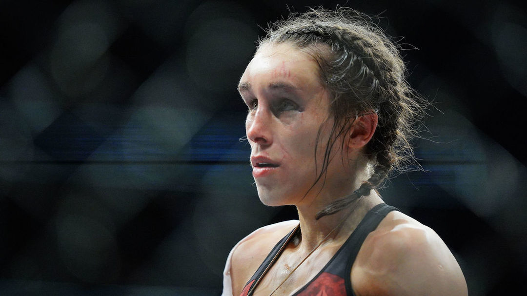 Jedrzejczyk suffers massive hematoma at UFC 248 | theScore
