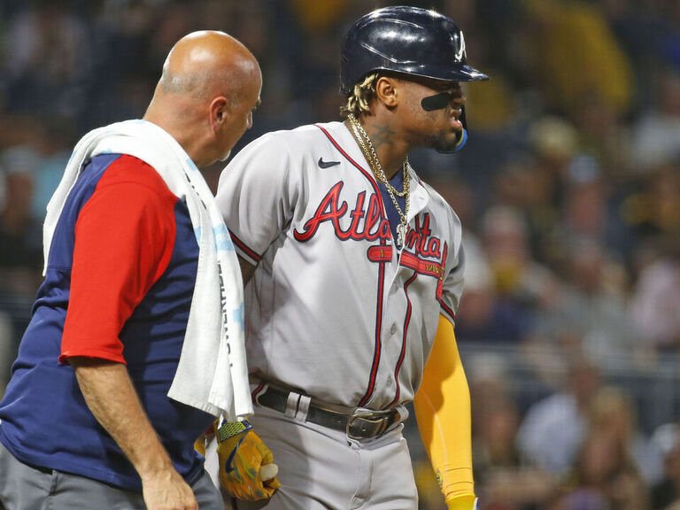 Braves star Acuna exits after HBP, X-rays negative | theScore.com