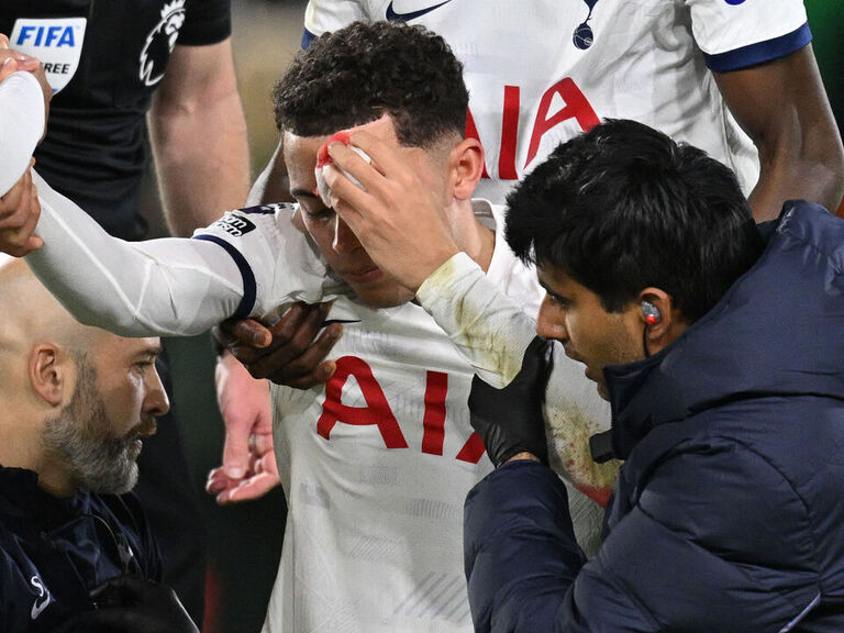 Football chiefs aware of concussion risk for decades, court told ...